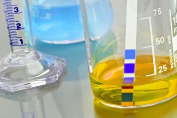 PH Indicator Strip: How It Works and Its Uses